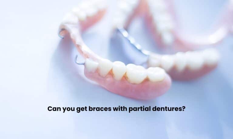 When Will You See Results with Dental Braces?